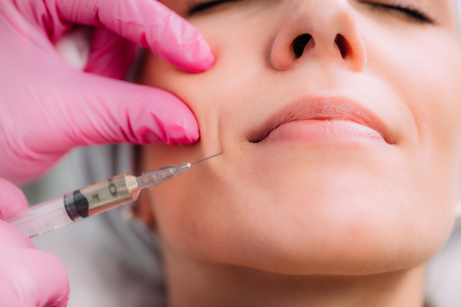 What are PRP Derma gel fillers? - Essex Med Spa
